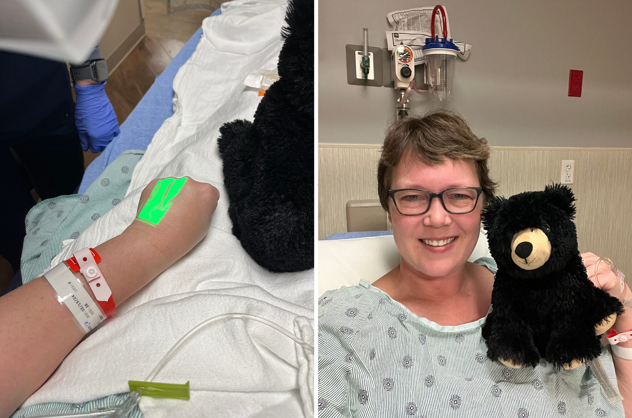 Revision Surgery Done! – Our Journey